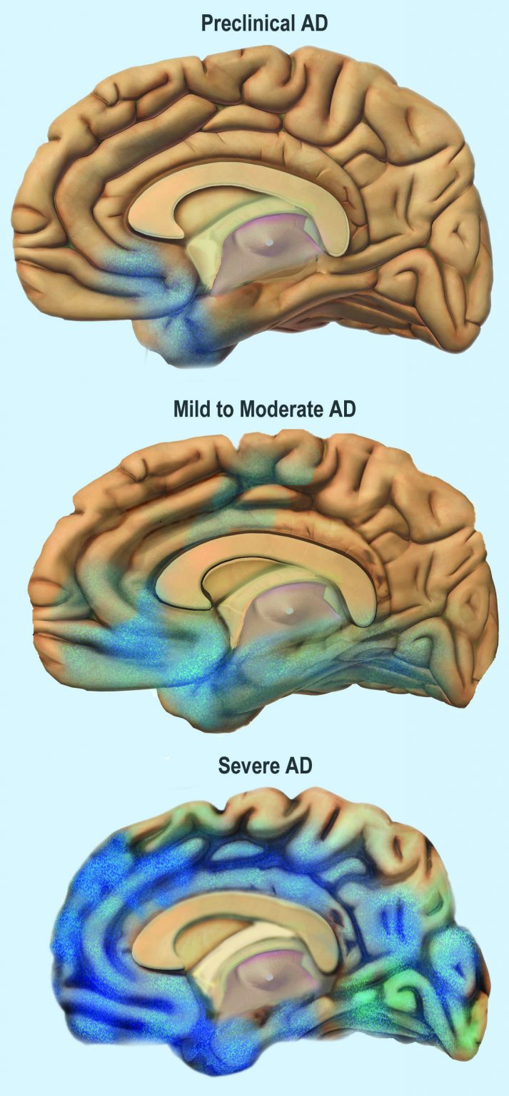 8.9 Case Study Conclusion: Fading Memory – Human Biology