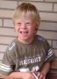 5.15 Genetic Disorders – Human Biology
