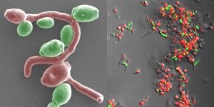 18.9 Disorders of the Female Reproductive System – Human Biology