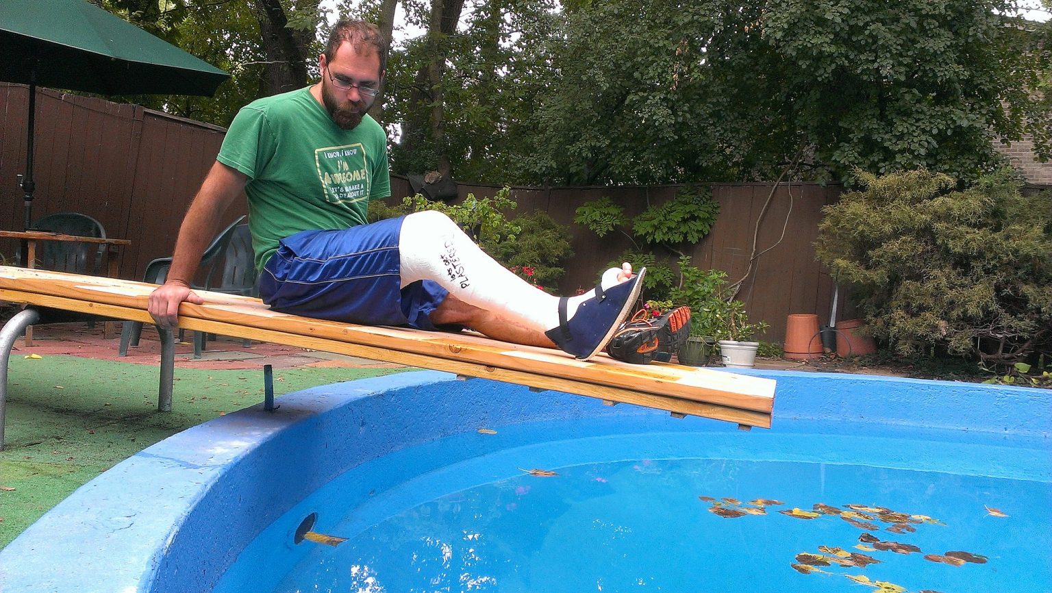 11.5 Bone Growth, Remodeling, and Repair – Human Biology