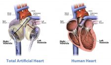 14.3 Heart – Human Biology