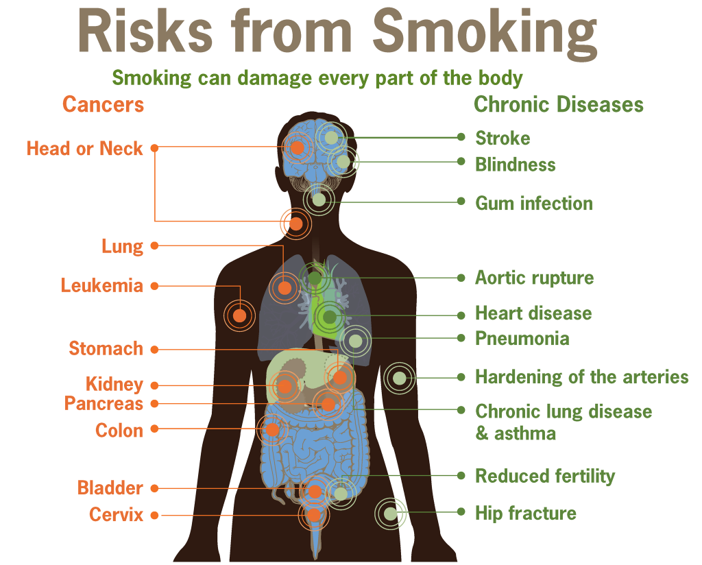 13.6 Smoking and Health – Human Biology