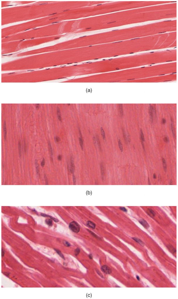 12.3 Types of Muscle Tissue – Human Biology