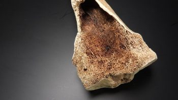 11.4 Structure of Bone – Human Biology