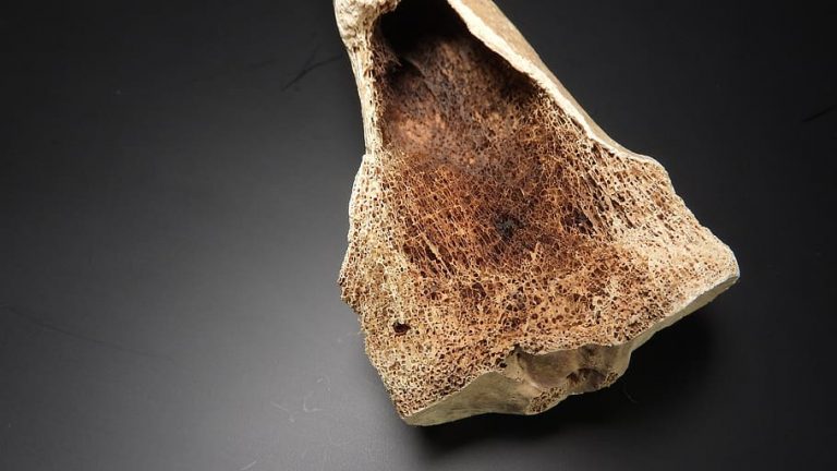 11.4 Structure of Bone – Human Biology