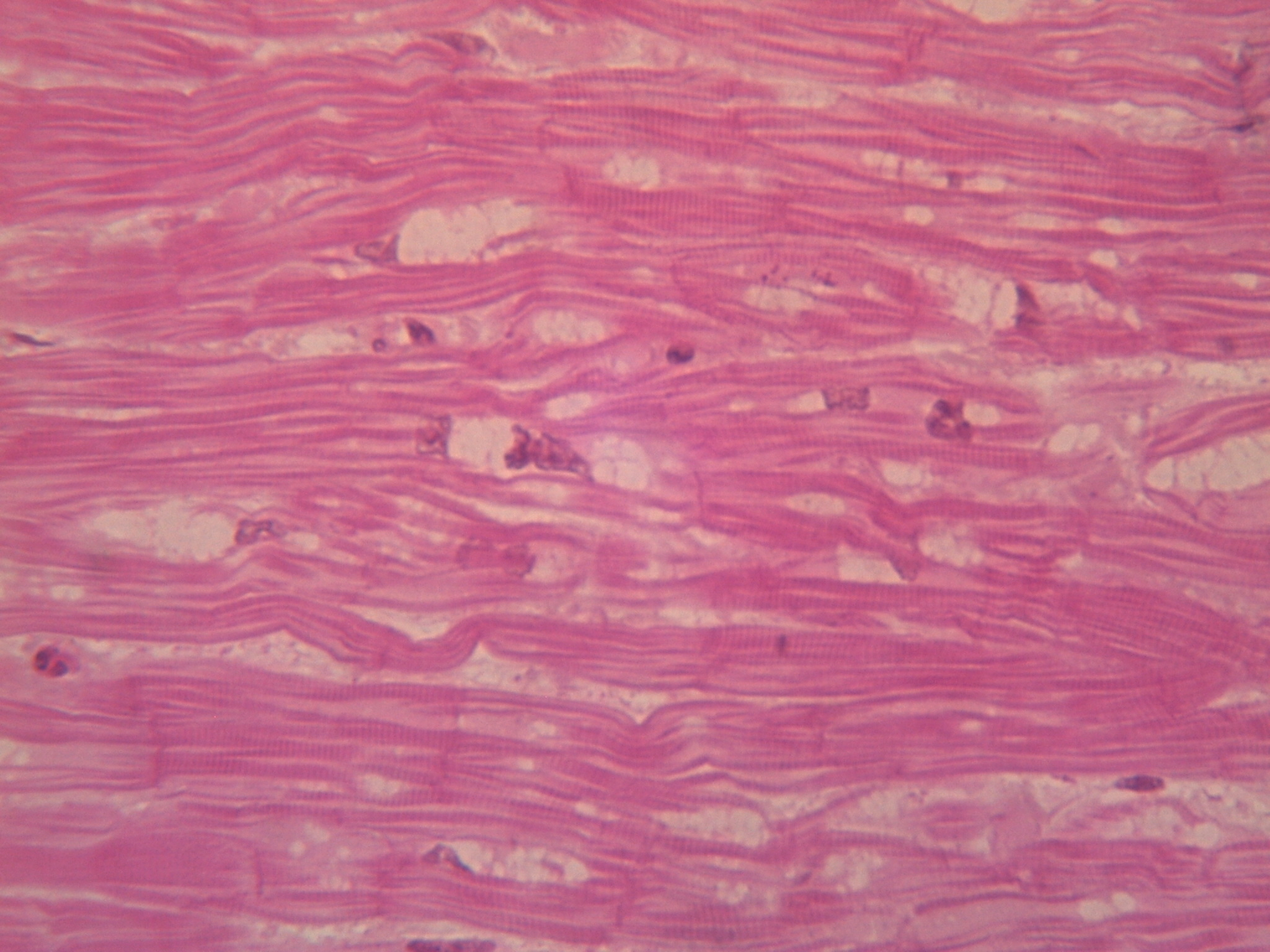 3 Types Of Muscle Tissue Under Microscope